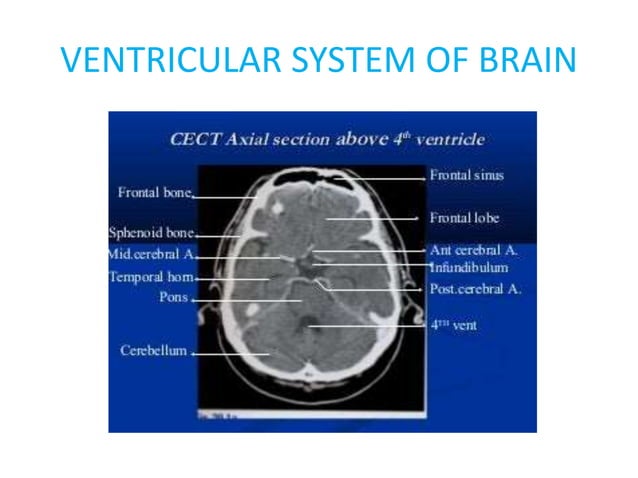 CT BRAIN ANATOMY.pptx | Brain and Nervous System Disorders | Diseases ...