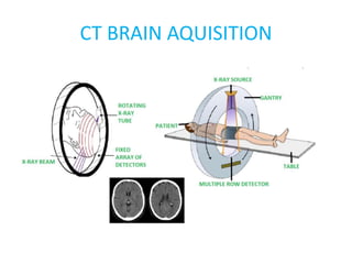 CT BRAIN ANATOMY.pptx | Brain and Nervous System Disorders | Diseases ...