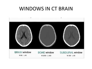 CT BRAIN ANATOMY.pptx | Brain and Nervous System Disorders | Diseases ...