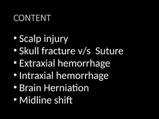 CT BRAIN IN ACUTE EMERGENCY dr sandra.pptx