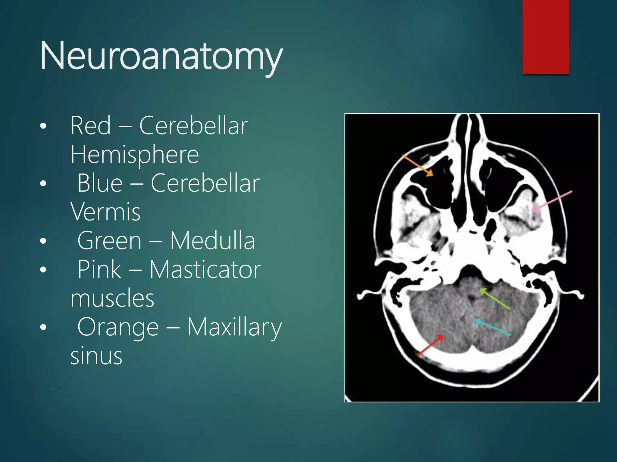 CT Brain interpretation | PPTX