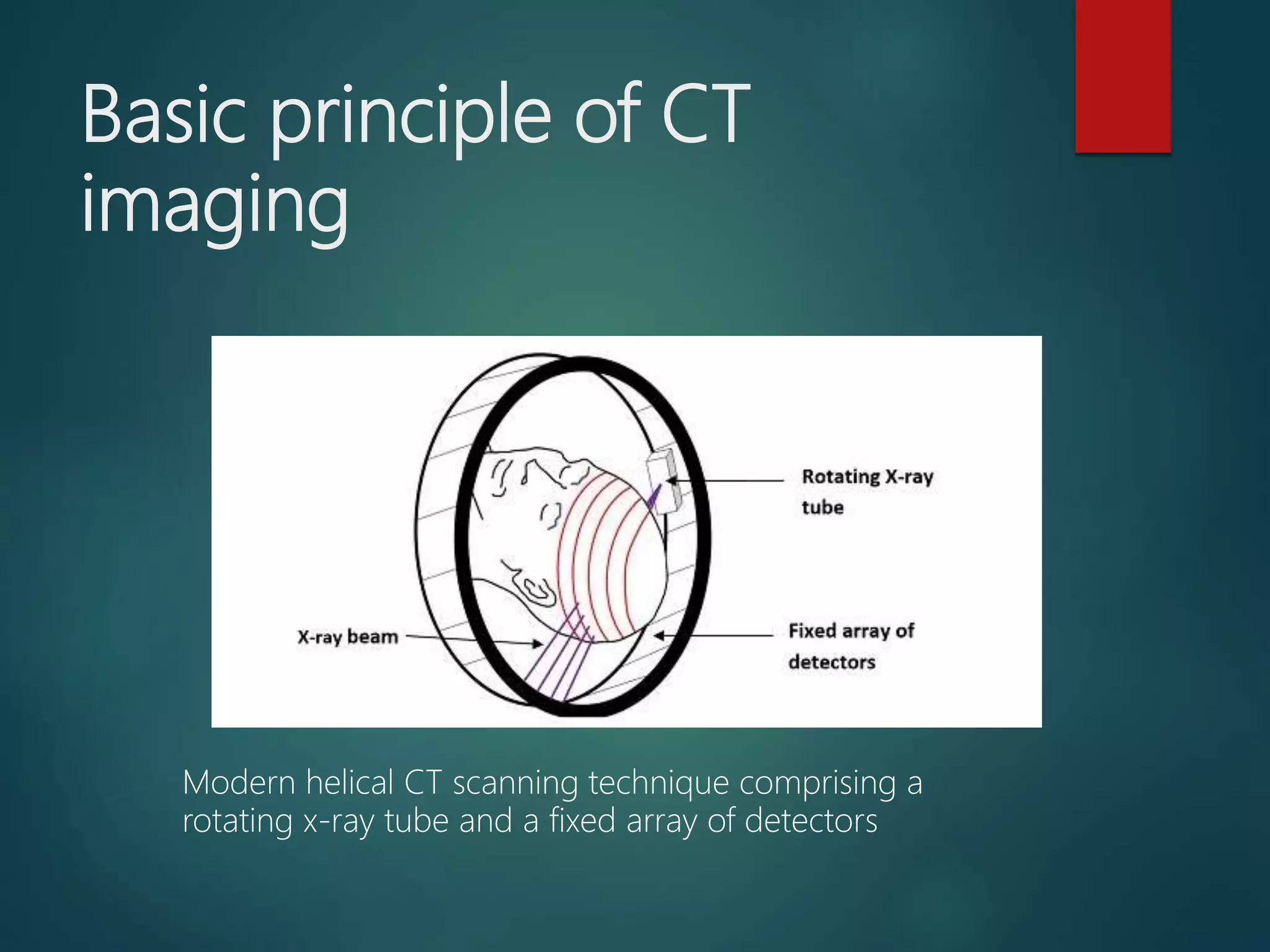 CT Brain interpretation | PPTX