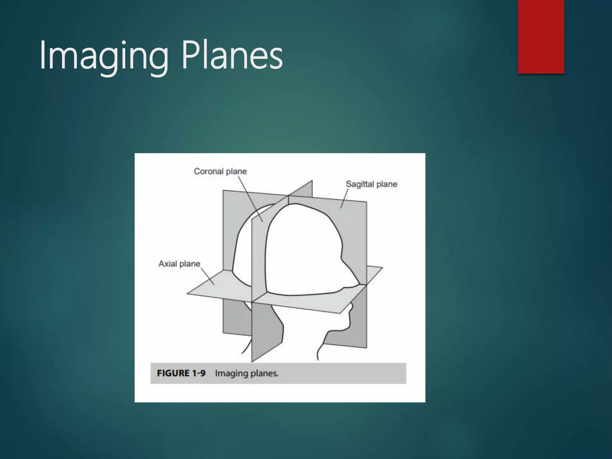 CT Brain interpretation | PPTX