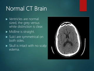 CT Brain interpretation | PPTX