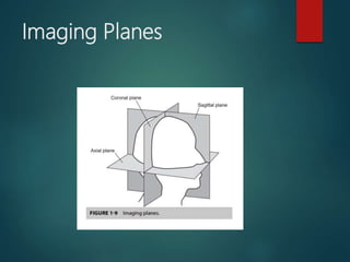 CT Brain interpretation | PPTX