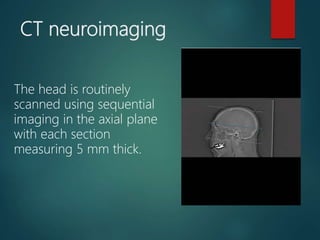 CT Brain interpretation | PPTX