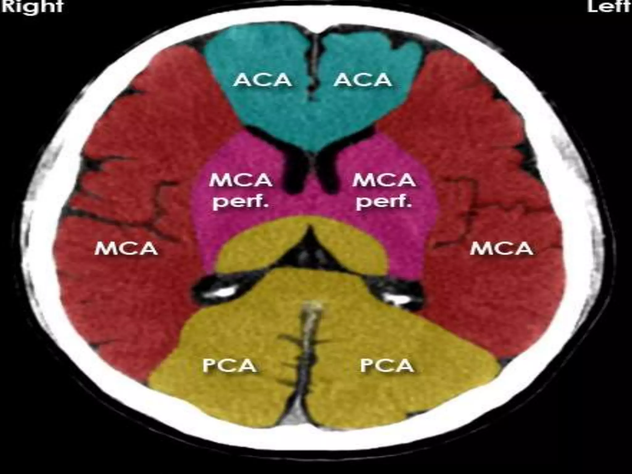 Ct brain presentation | PPTX