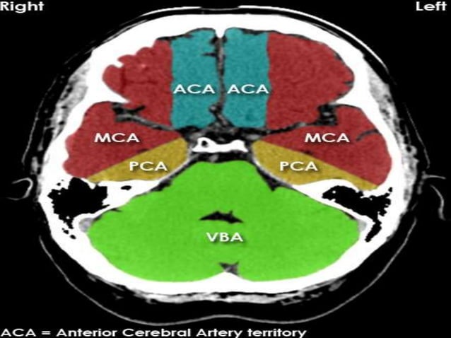 Ct brain presentation | PPTX
