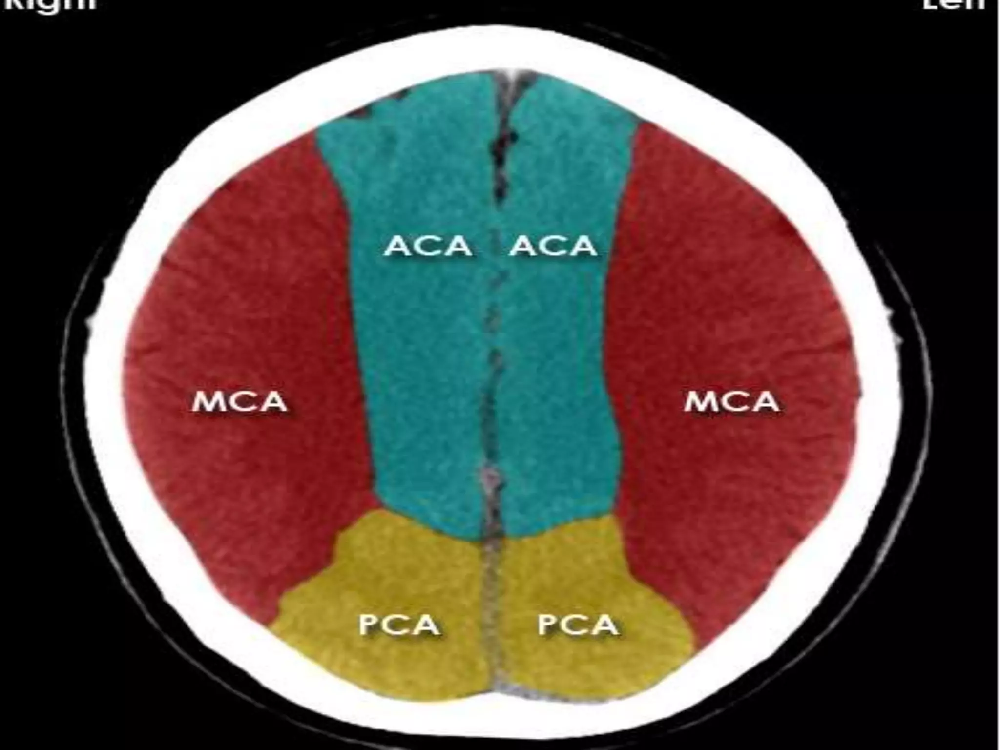 Ct brain presentation | PPTX