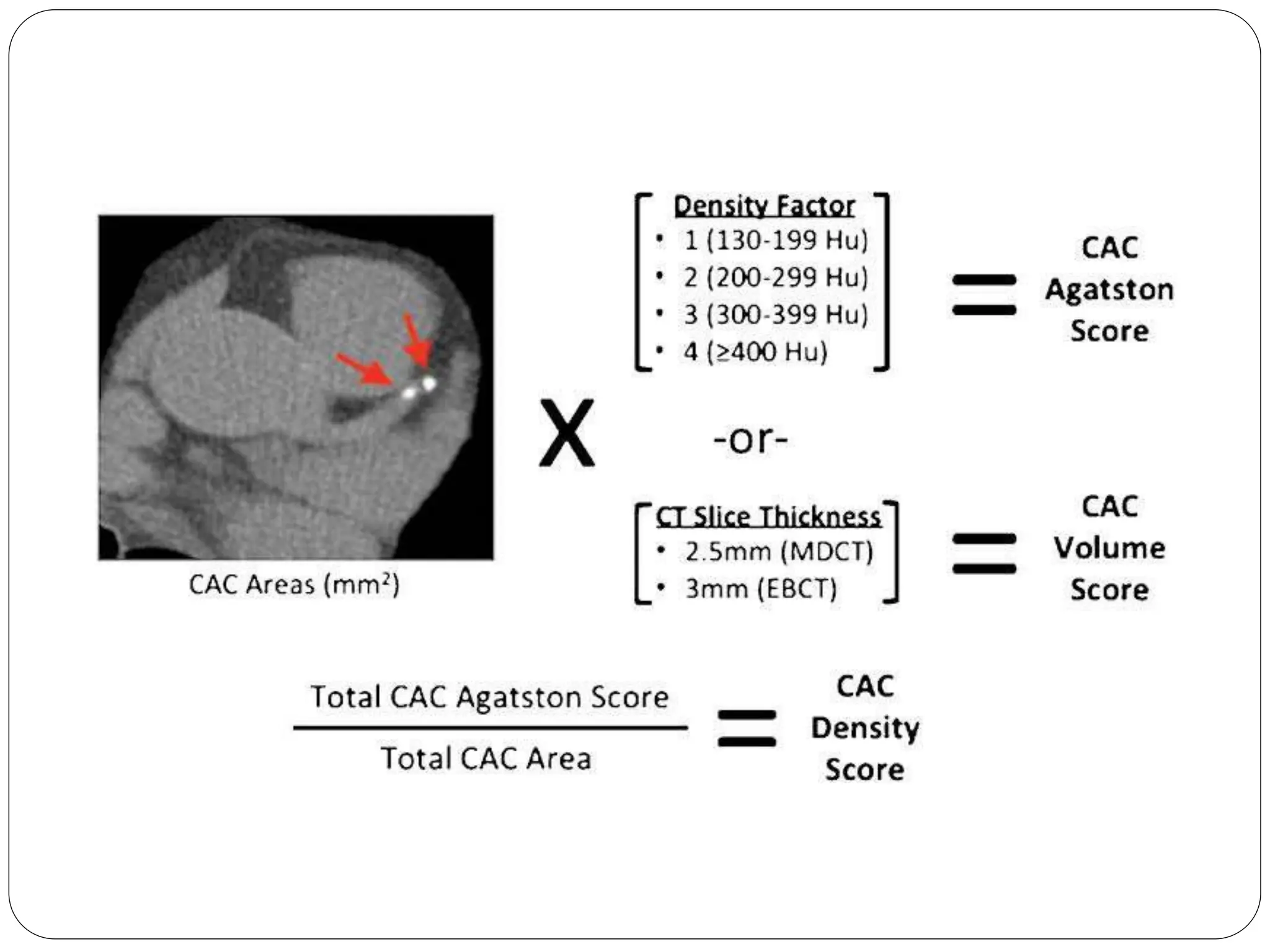 CT calcium score.pptx