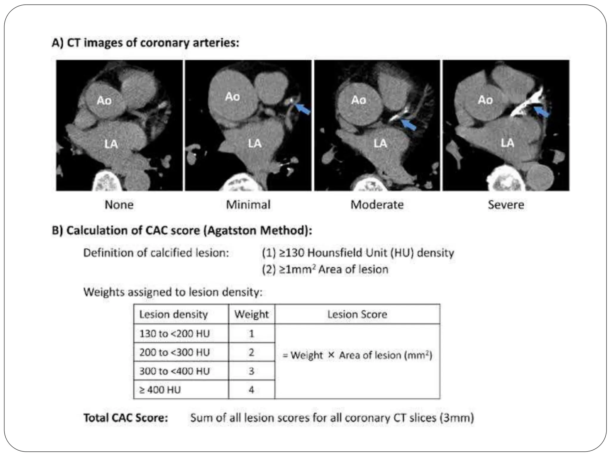 CT calcium score.pptx