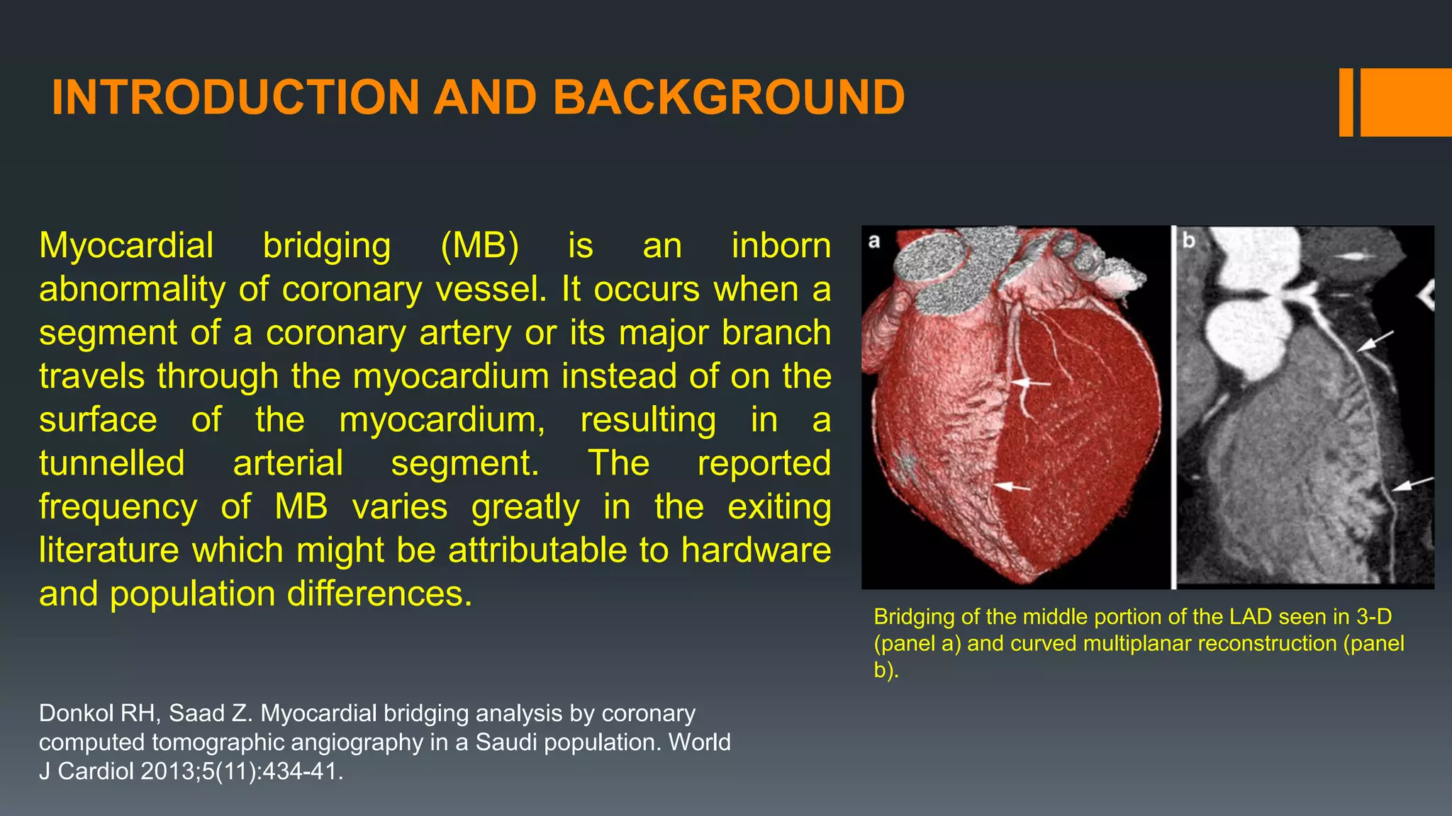 Cardiac CT Angiography to detect Myocardial Bridging | PDF