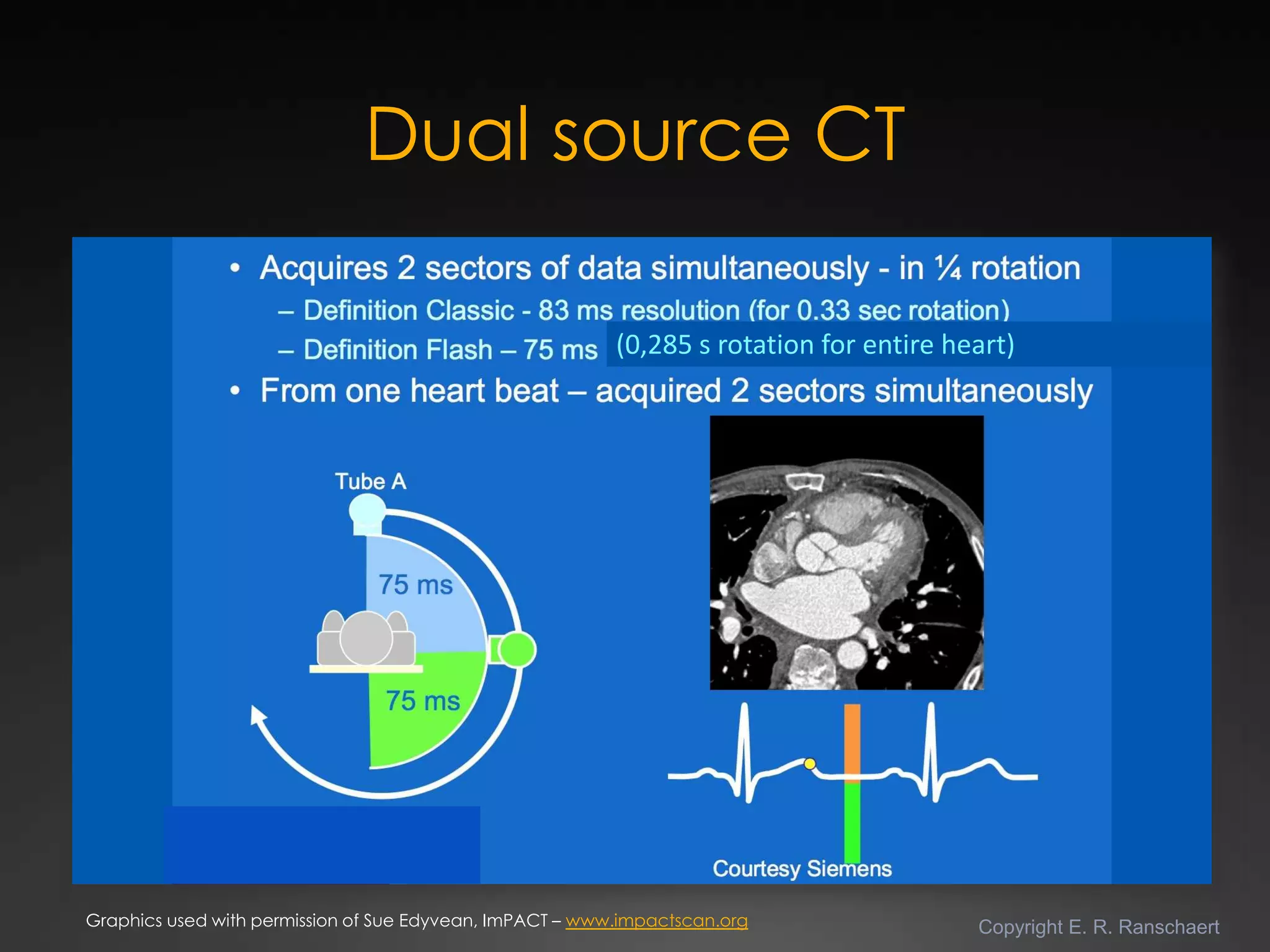 State-of-the-art Cardiac CT of the coronary arteries | PPTX