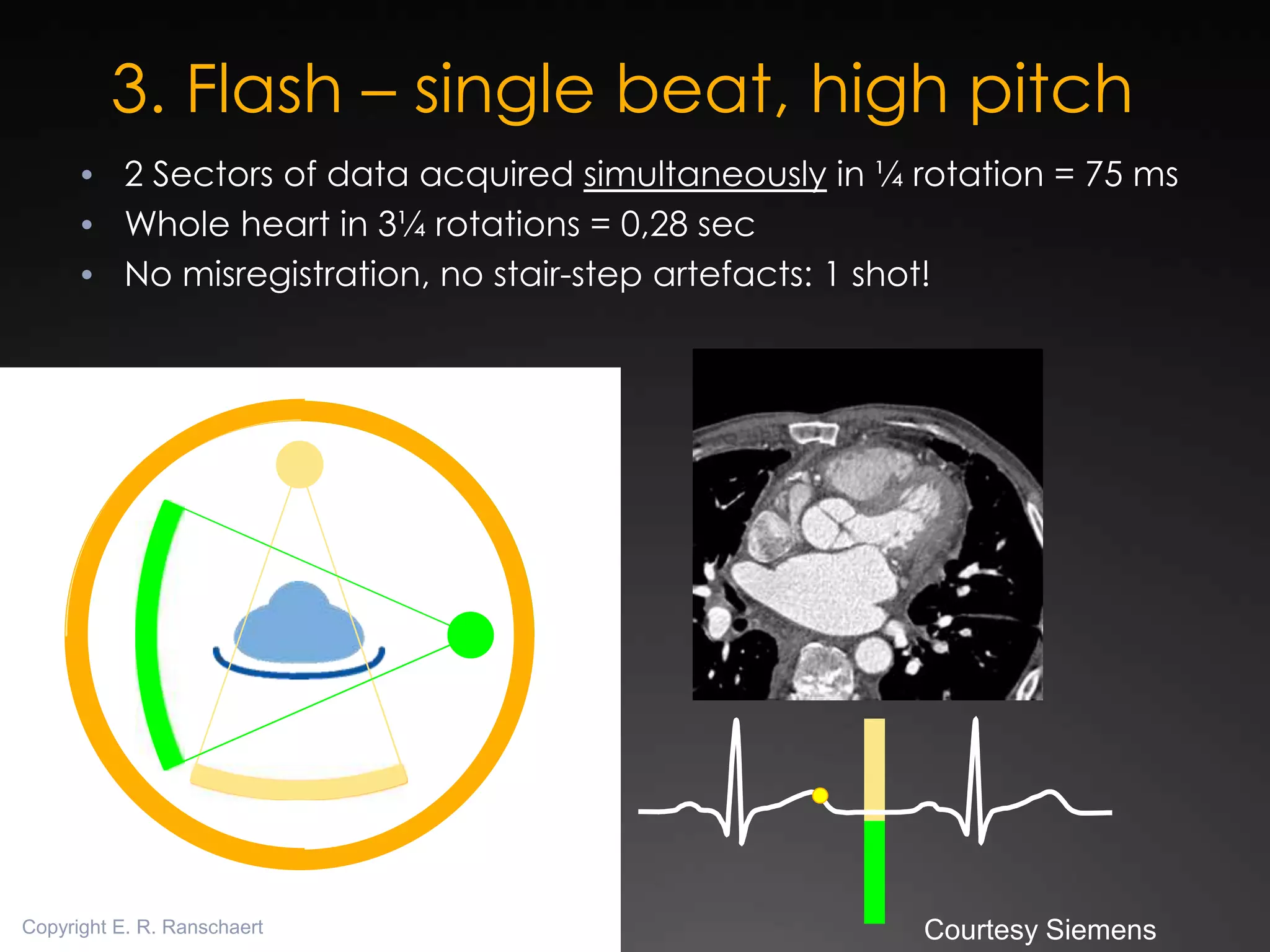 State-of-the-art Cardiac CT of the coronary arteries | PPTX