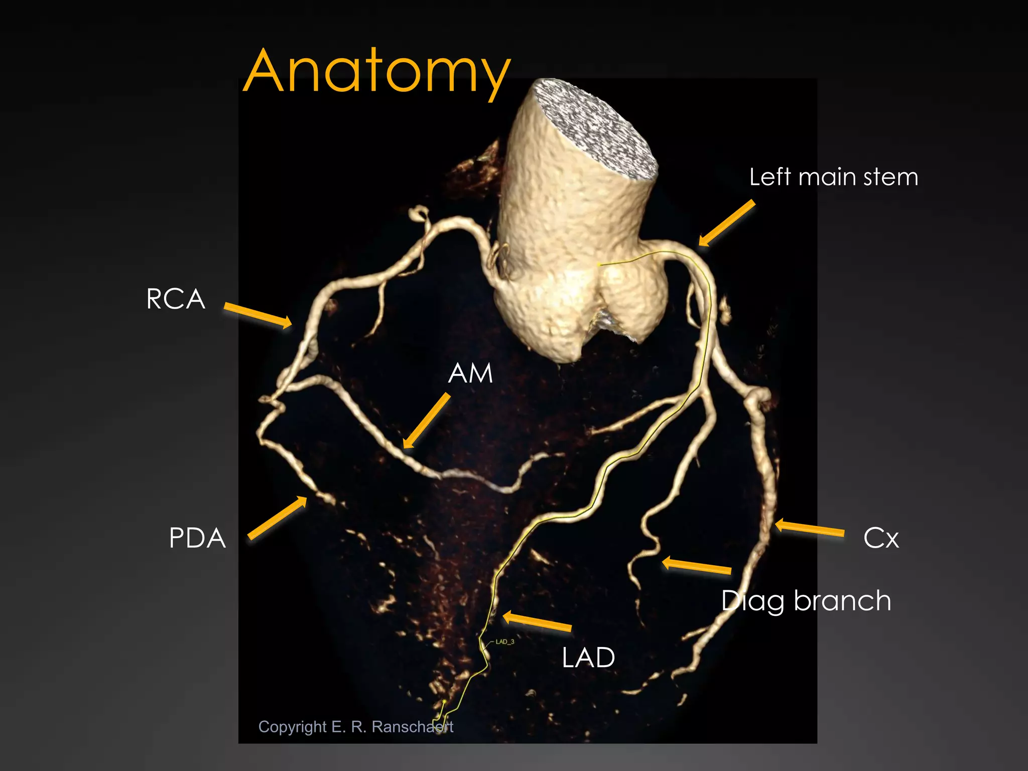 State-of-the-art Cardiac CT of the coronary arteries | PPTX