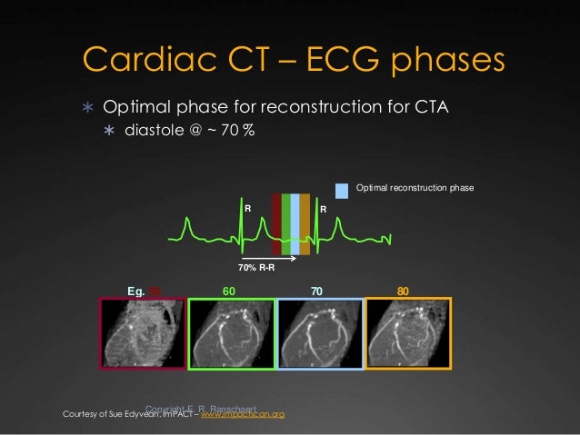 State-of-the-art Cardiac CT of the coronary arteries