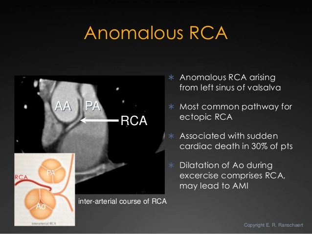 State-of-the-art Cardiac CT of the coronary arteries