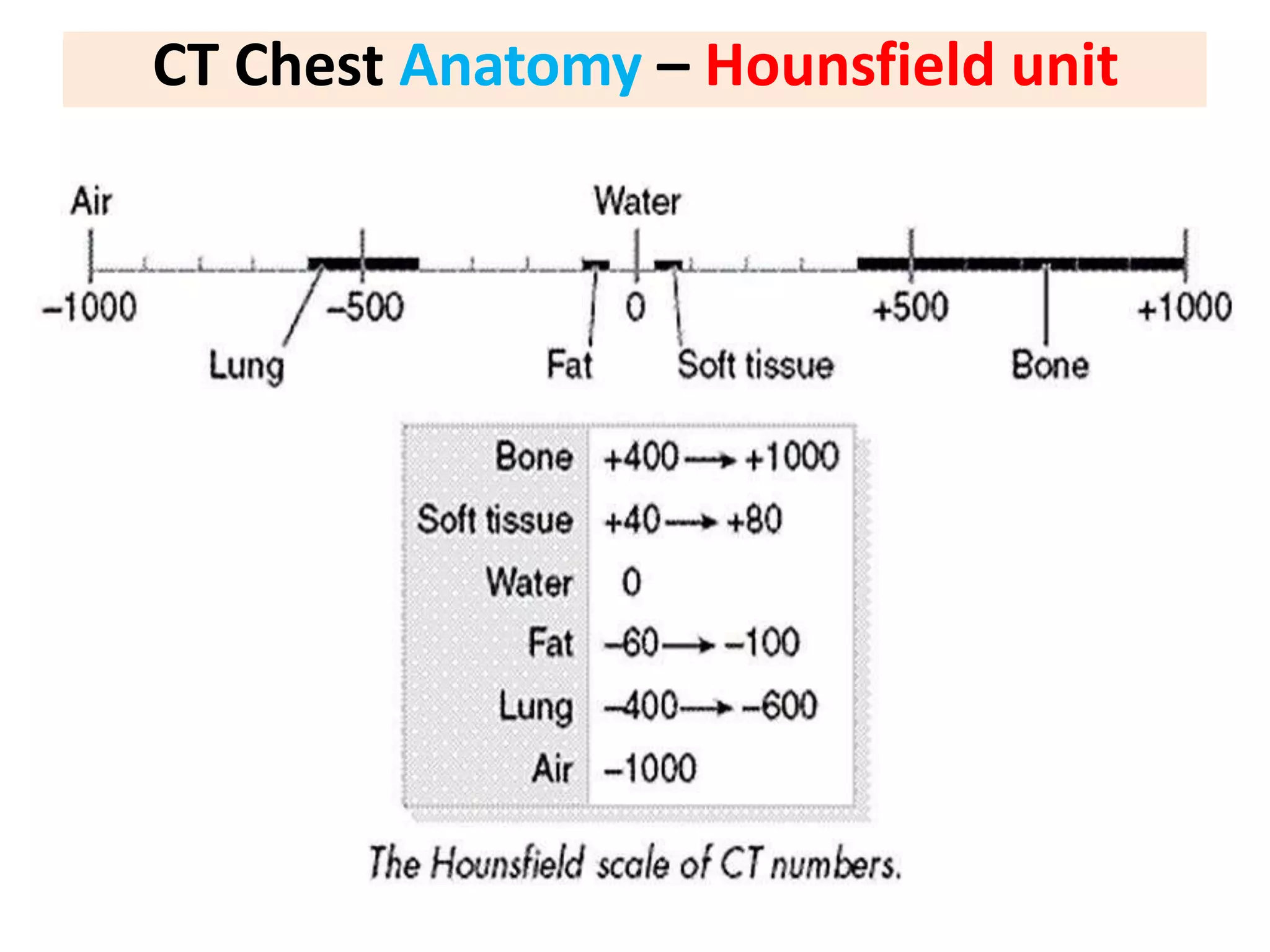 Basics of CT chest | PPTX