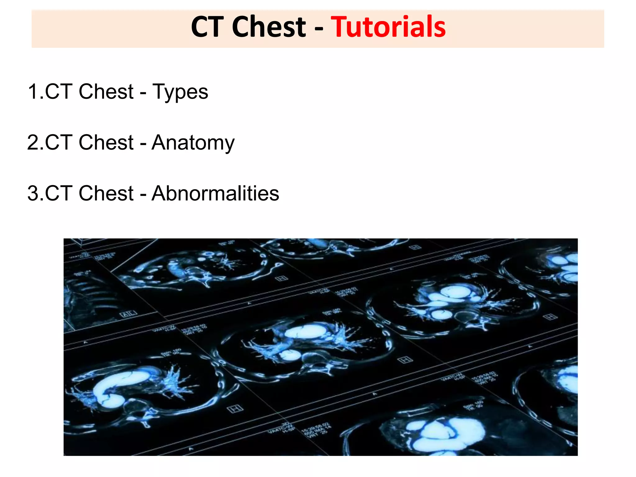 Basics of CT chest | PPTX
