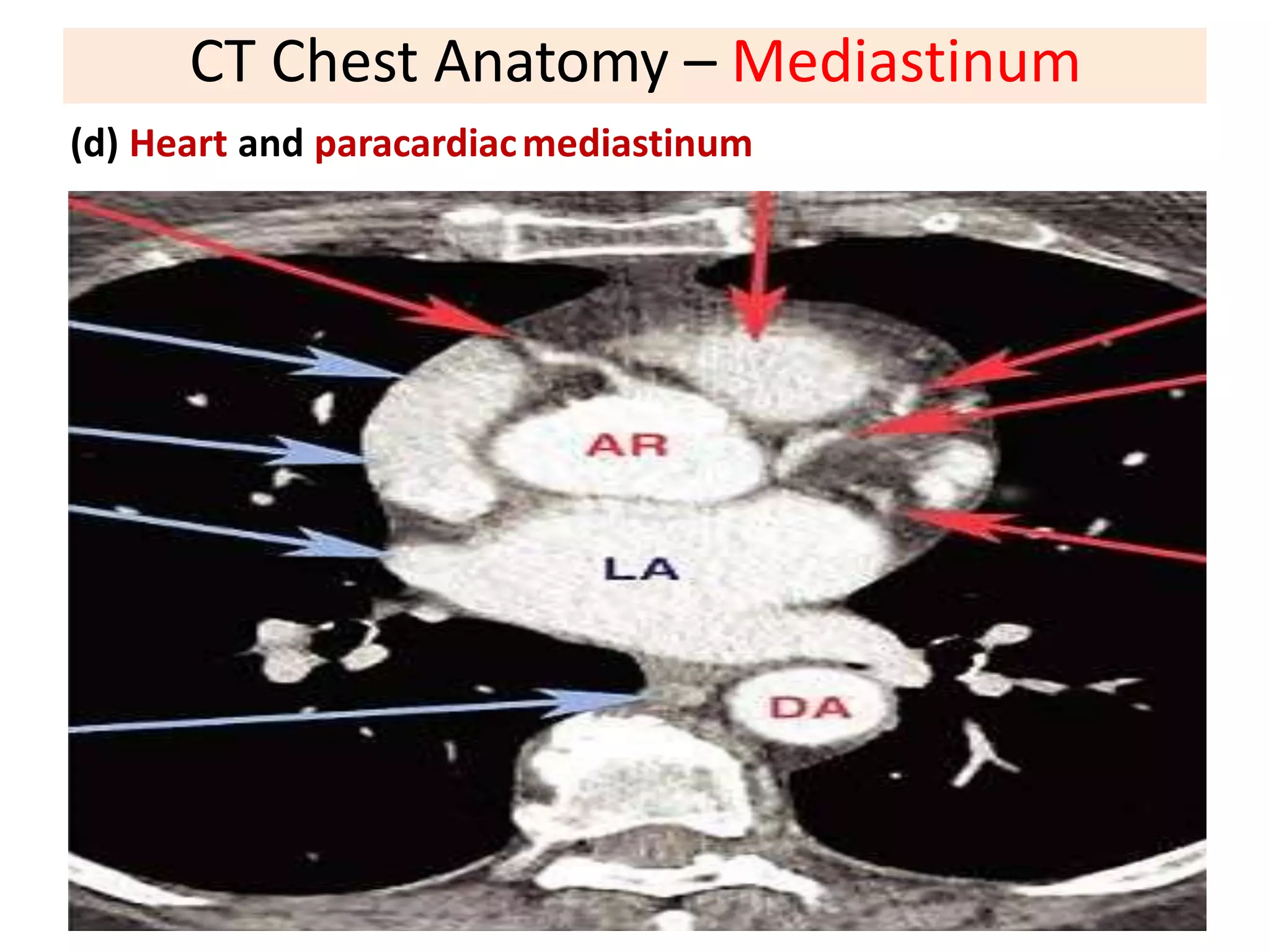 Basics of CT chest | PPTX