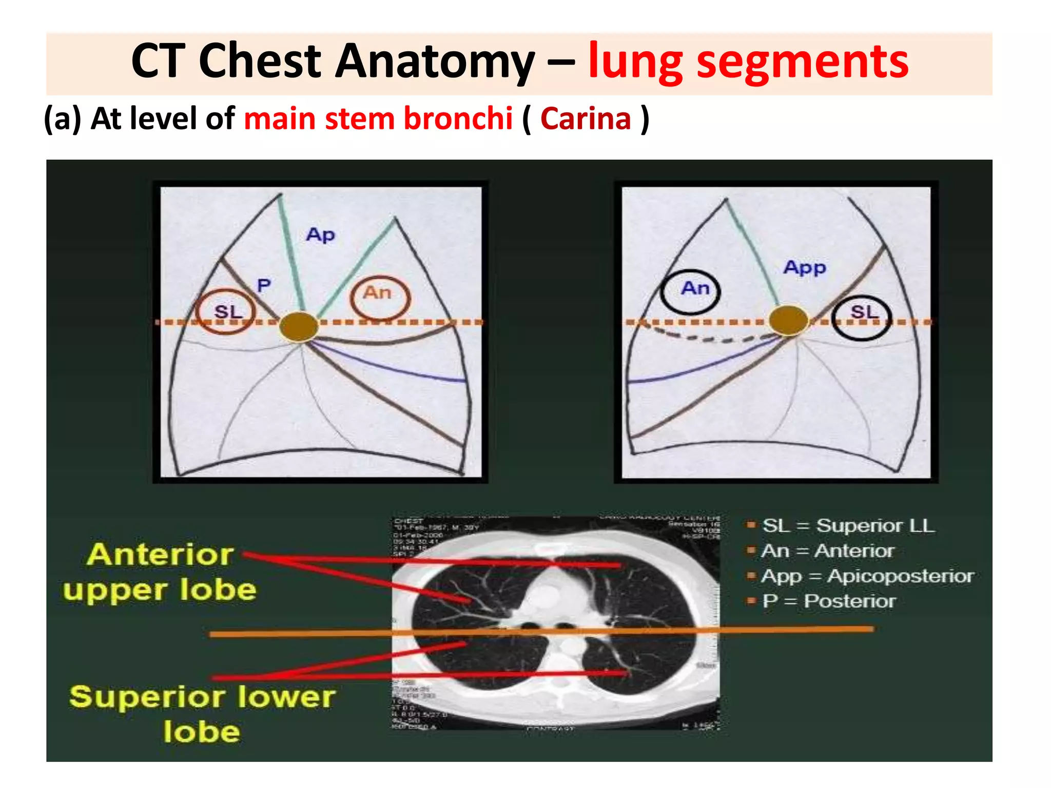 Basics of CT chest | PPTX