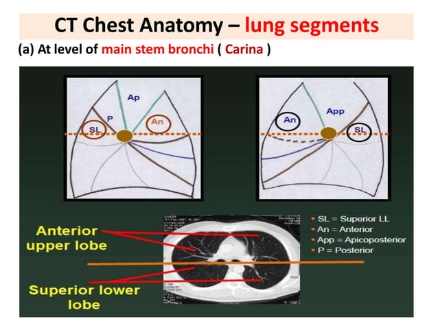 Basics of CT chest | PPTX | Lung and Respiratory Health | Diseases and ...