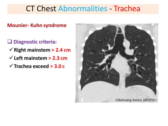 Basics of CT chest | PPTX | Lung and Respiratory Health | Diseases and ...
