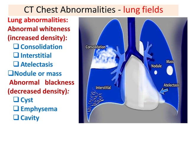 Basics of CT chest | PPTX | Lung and Respiratory Health | Diseases and ...