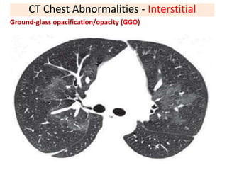 Basics of CT chest | PPTX