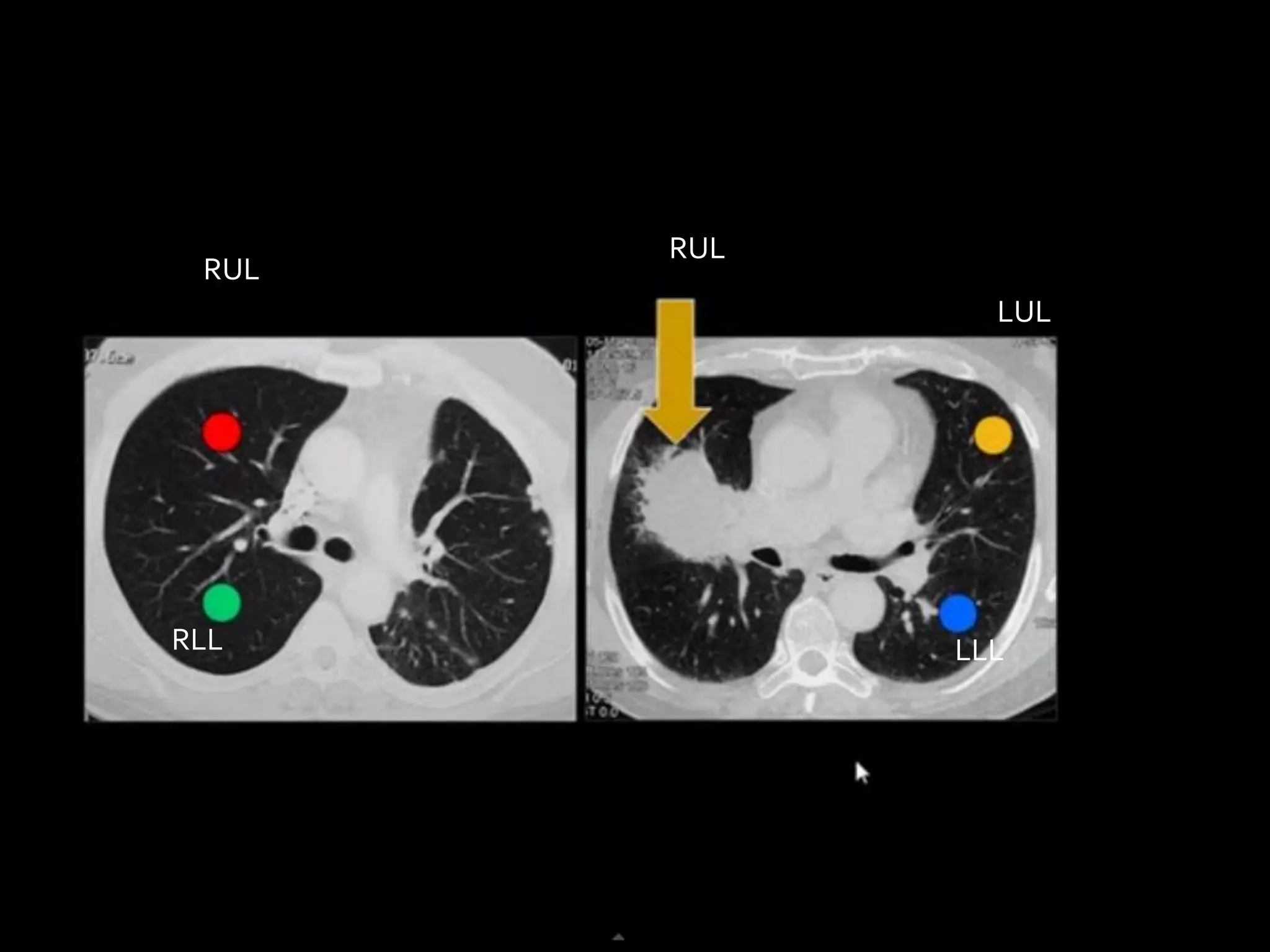 CT CHEST ANATOMY | PPTX
