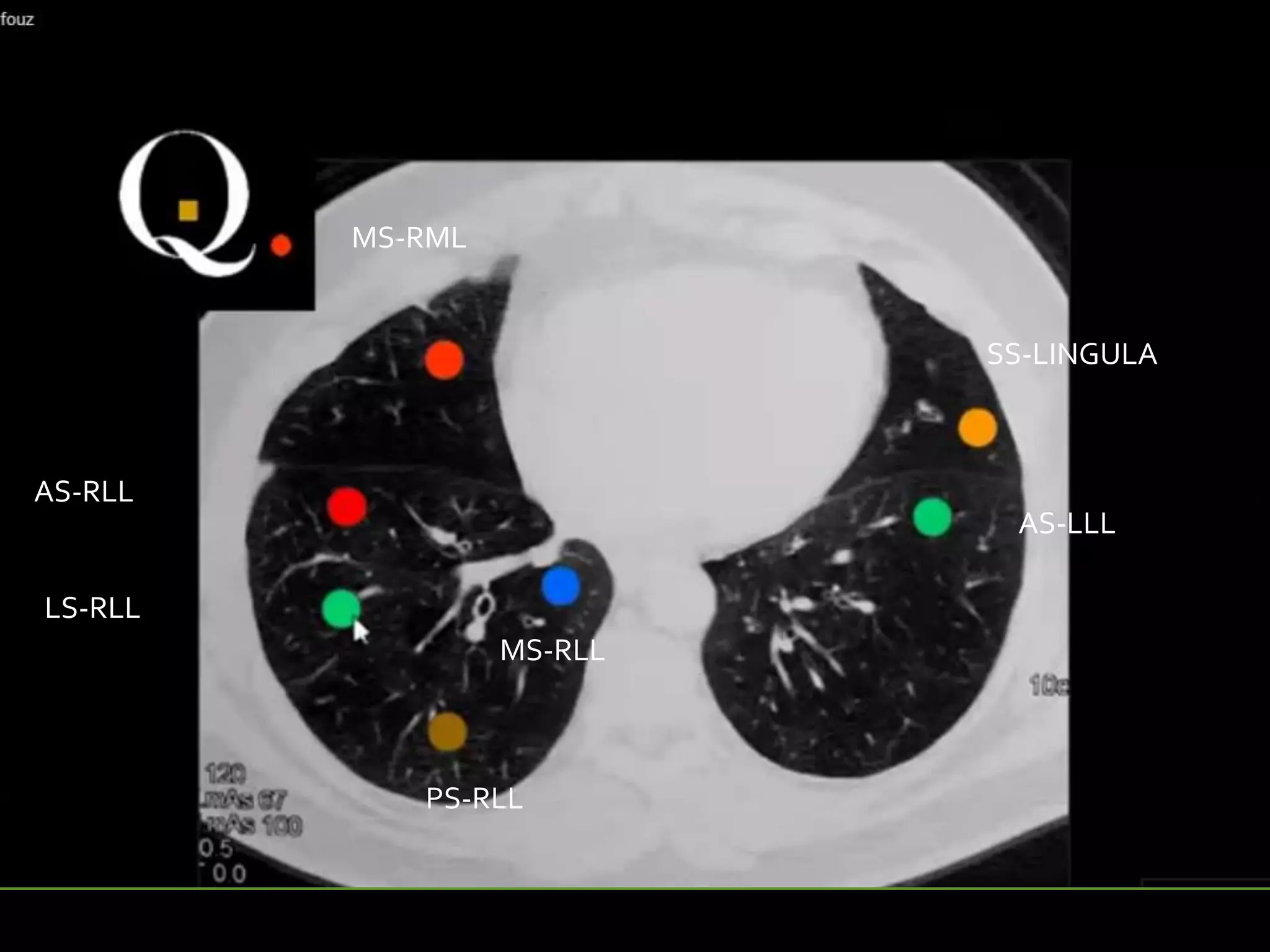 CT CHEST ANATOMY | PPTX