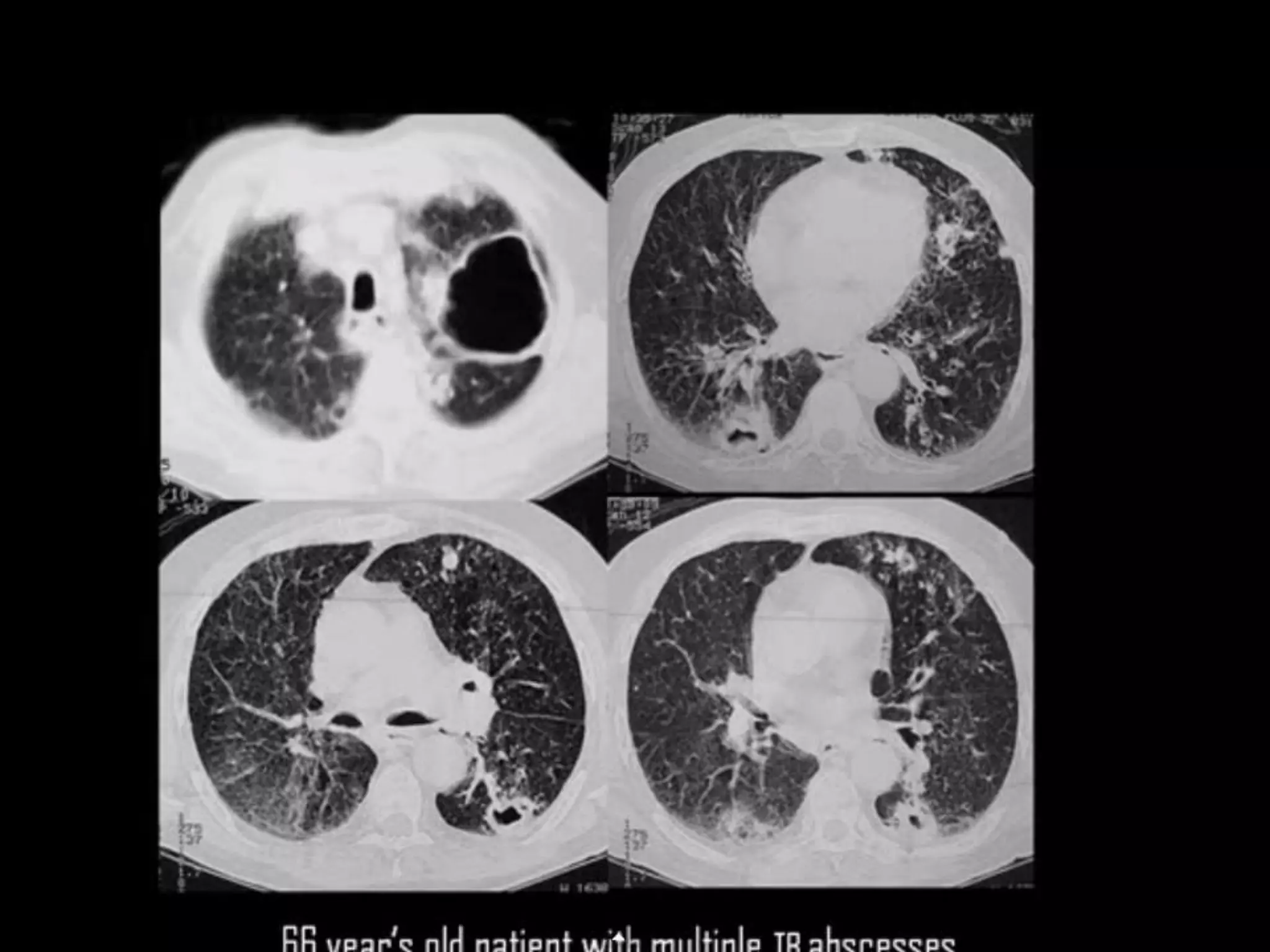 CT CHEST ANATOMY | PPTX