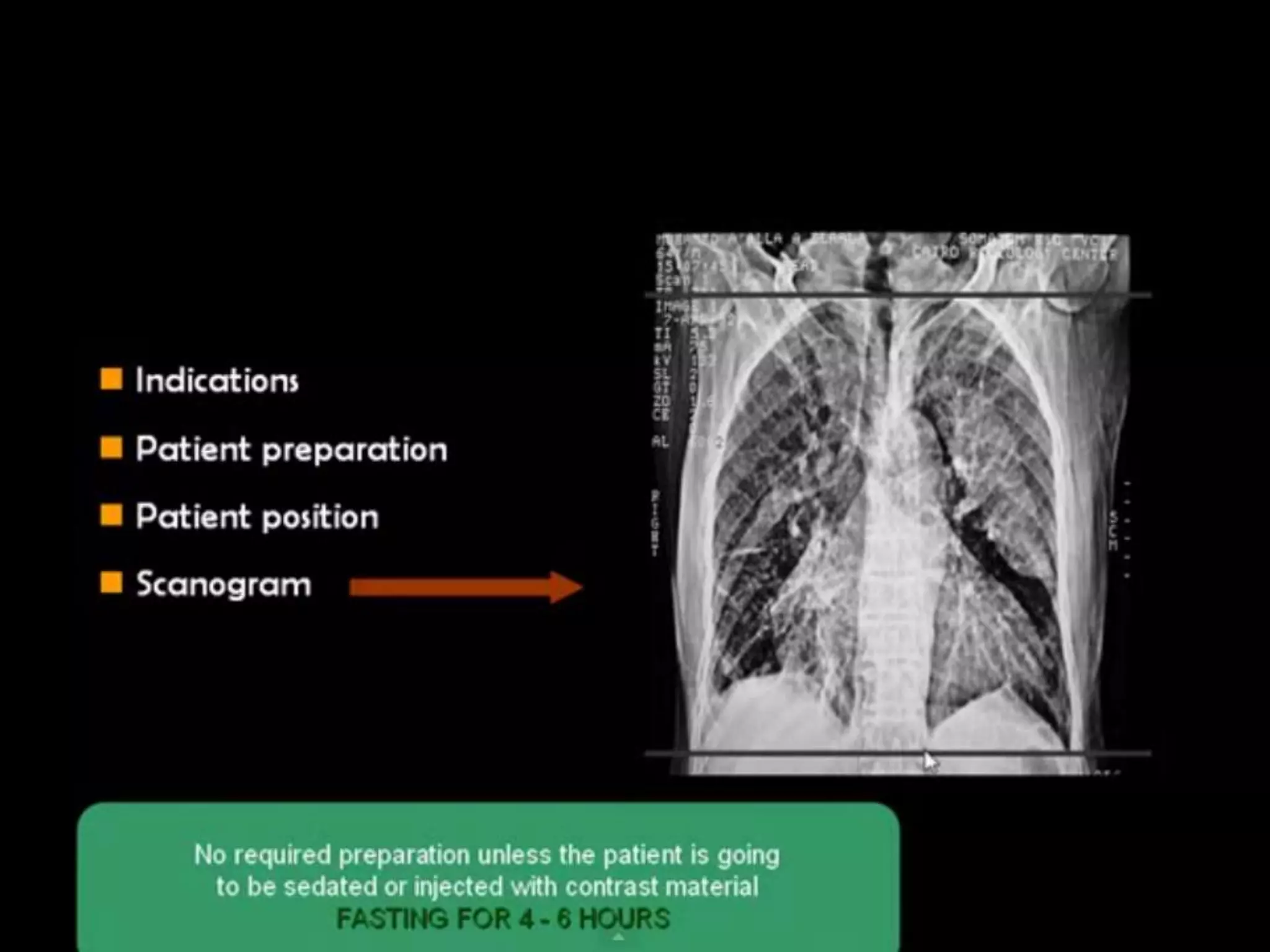 CT CHEST ANATOMY | PPTX