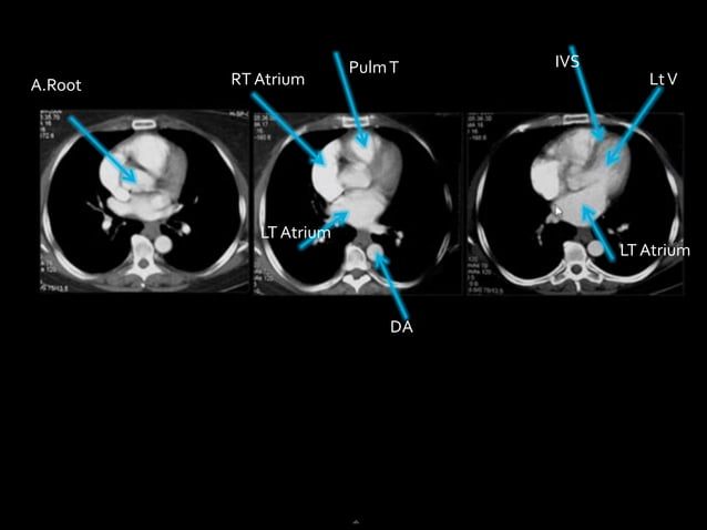 CT CHEST ANATOMY | PPTX