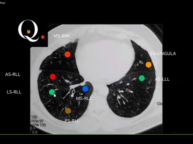 CT CHEST ANATOMY | PPTX
