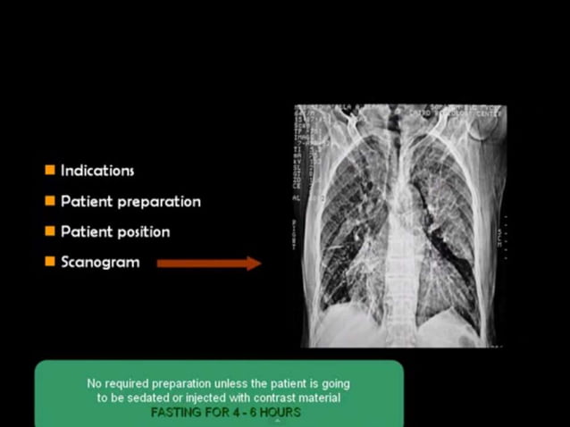 CT CHEST ANATOMY | PPTX