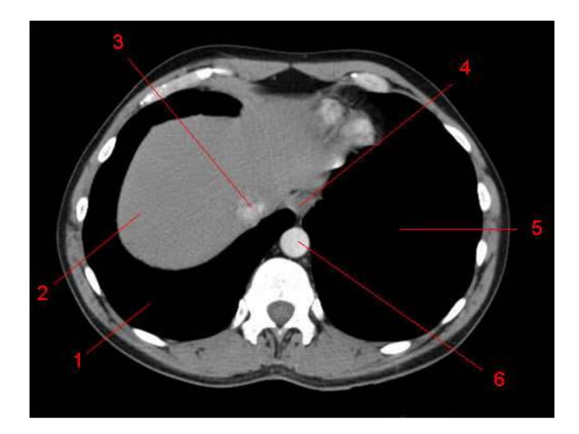 Ct chest anatomy | PPTX