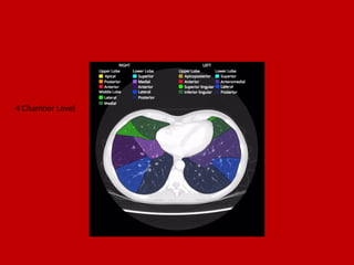 CT CHEST BASICS new.pptx - Basic interpretation of CT chest ...