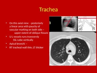CT CHEST BASICS new.pptx - Basic interpretation of CT chest ...