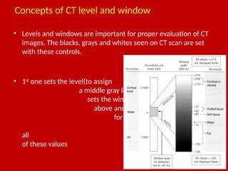 CT CHEST BASICS new.pptx - Basic interpretation of CT chest ...