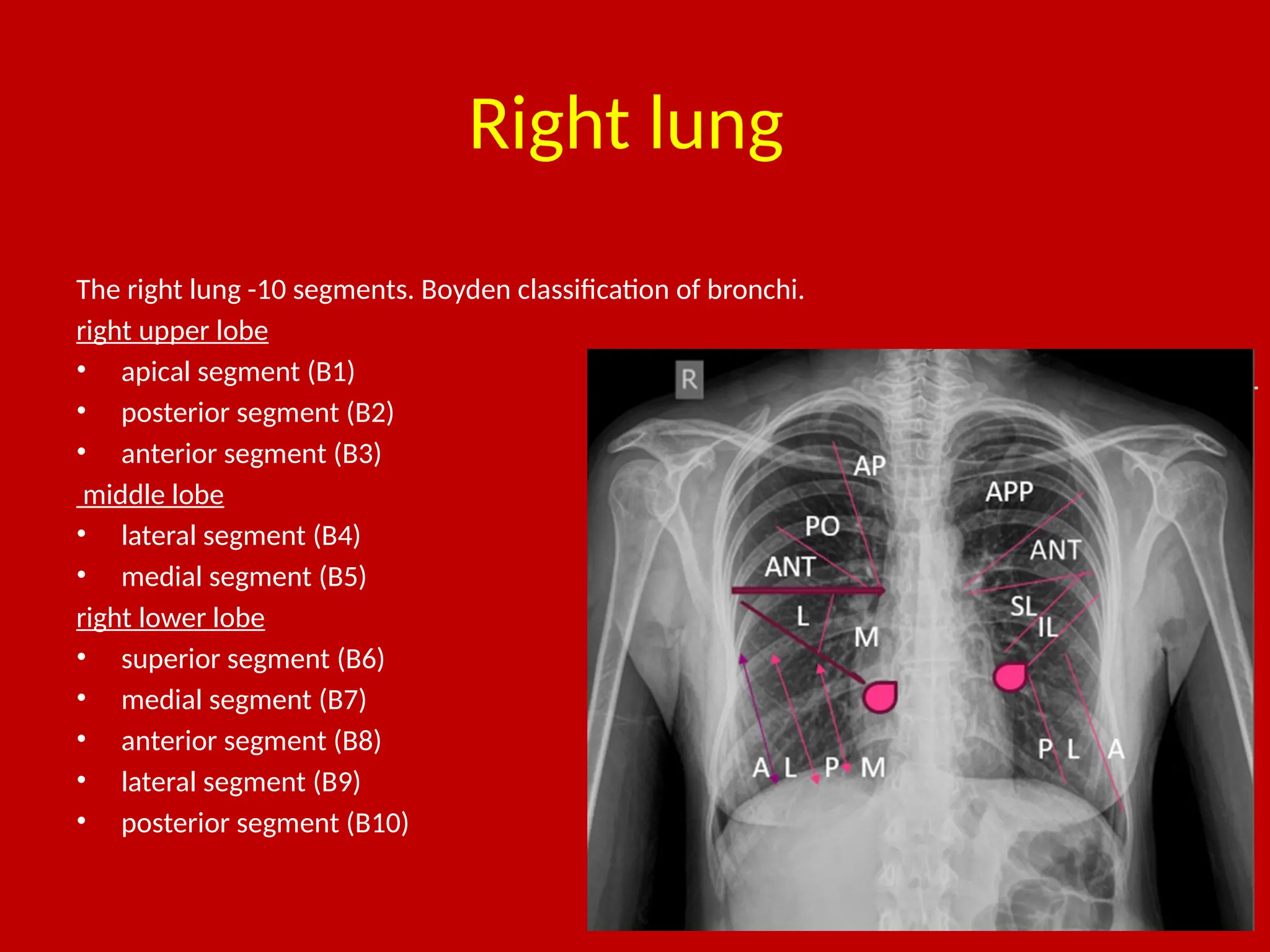 Basic interpretation of CT chest- identification of lobes and segments ...