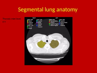 Basic interpretation of CT chest- identification of lobes and segments ...
