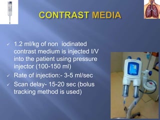 CT Procedure of Thorax (CT Chest) | PPTX