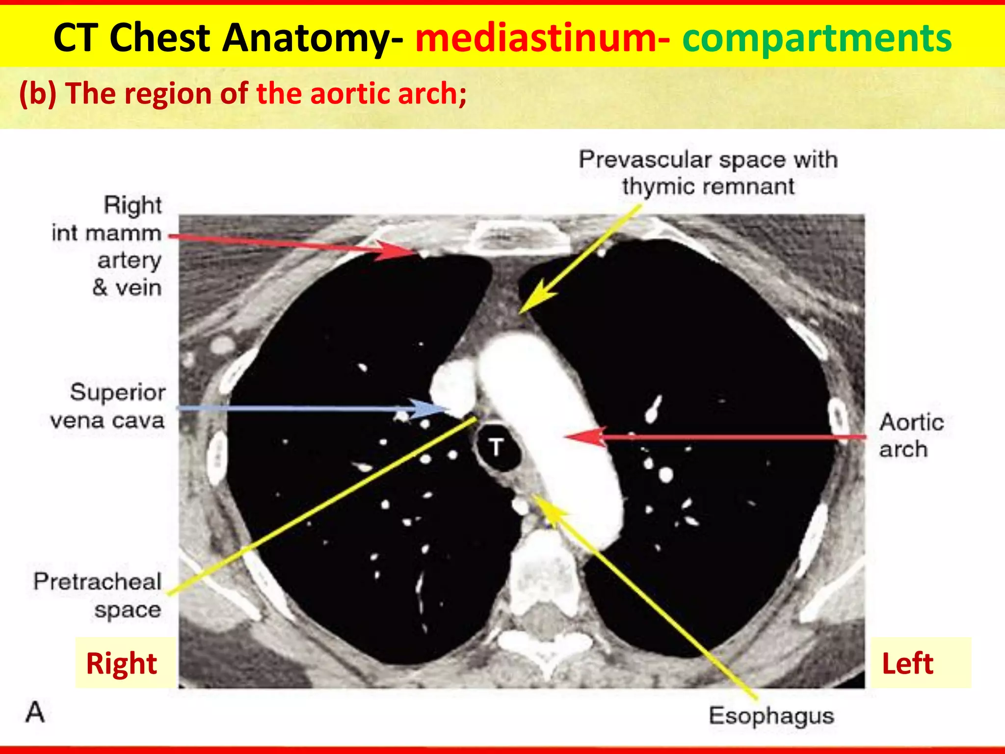 Ct chest fundamentals | PDF