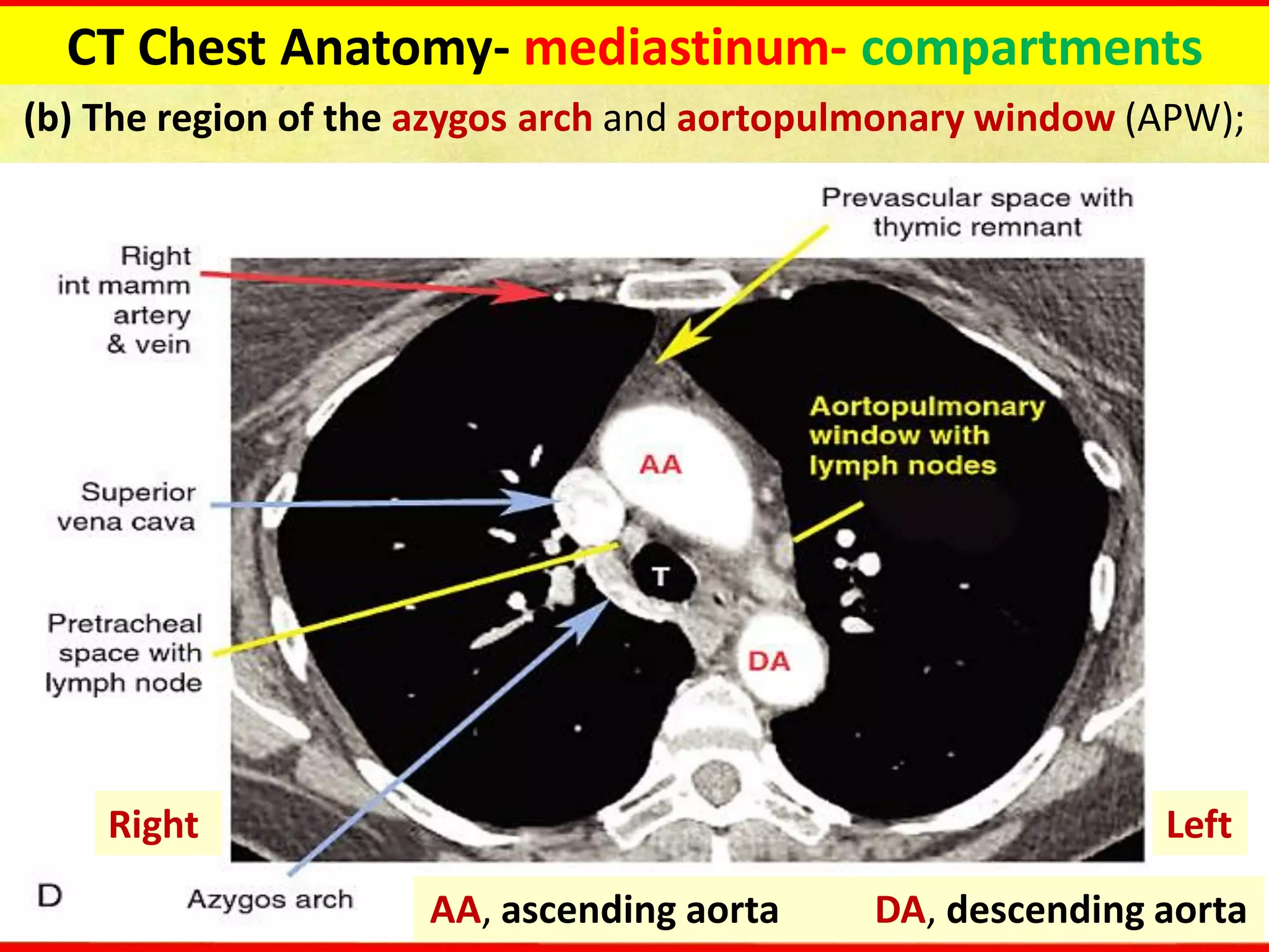 Ct chest fundamentals | PDF