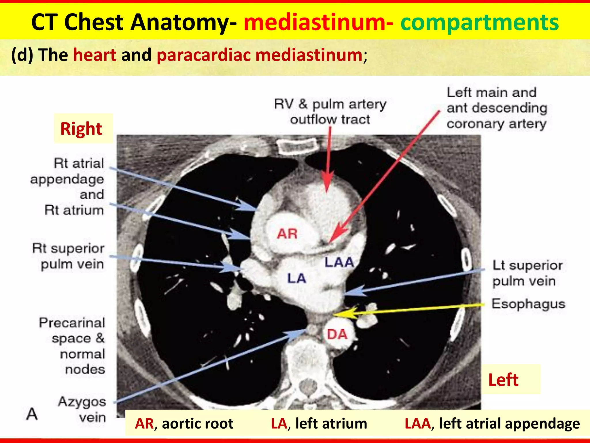 Ct chest fundamentals | PDF
