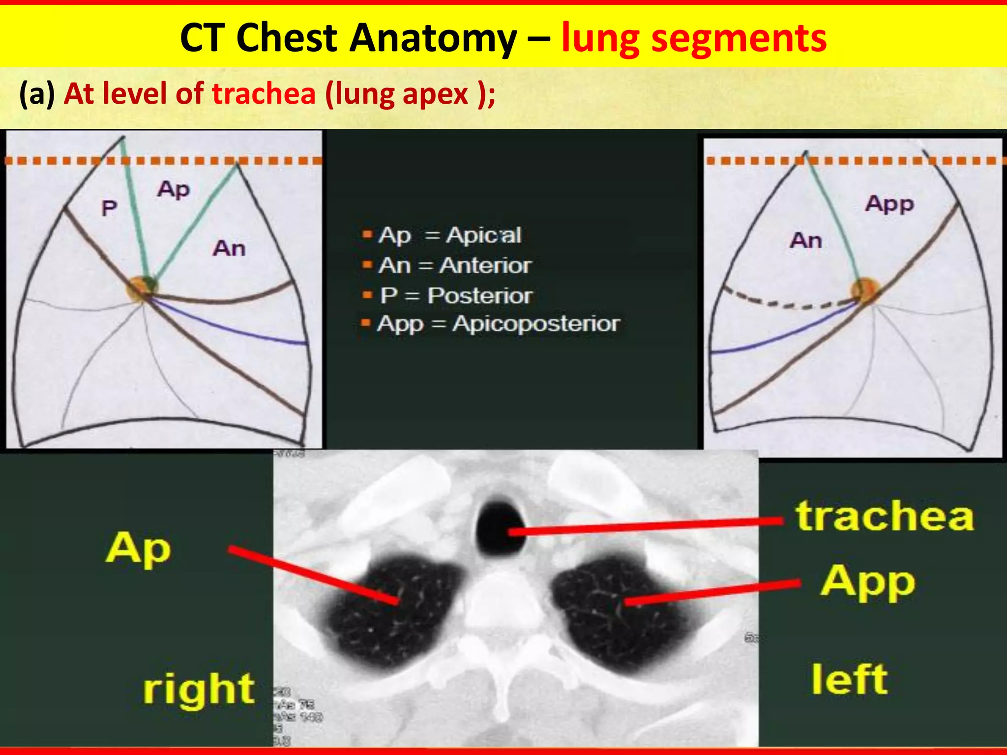 Ct chest fundamentals | PDF
