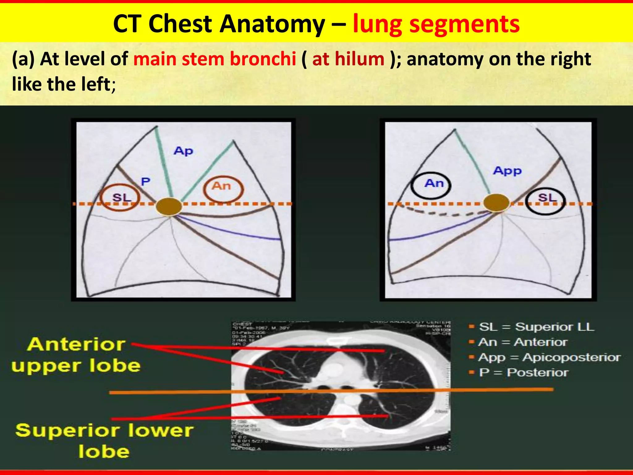 Ct chest fundamentals | PDF