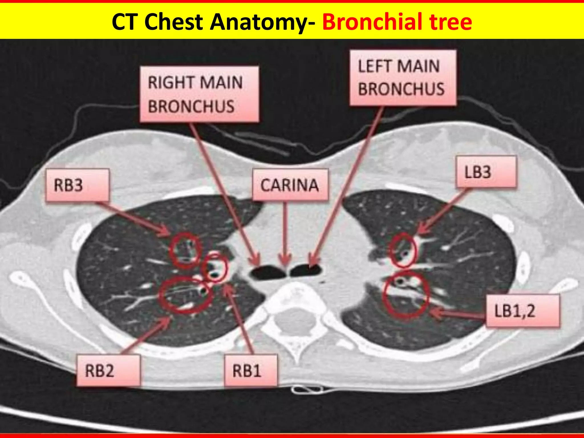 Ct chest fundamentals | PDF
