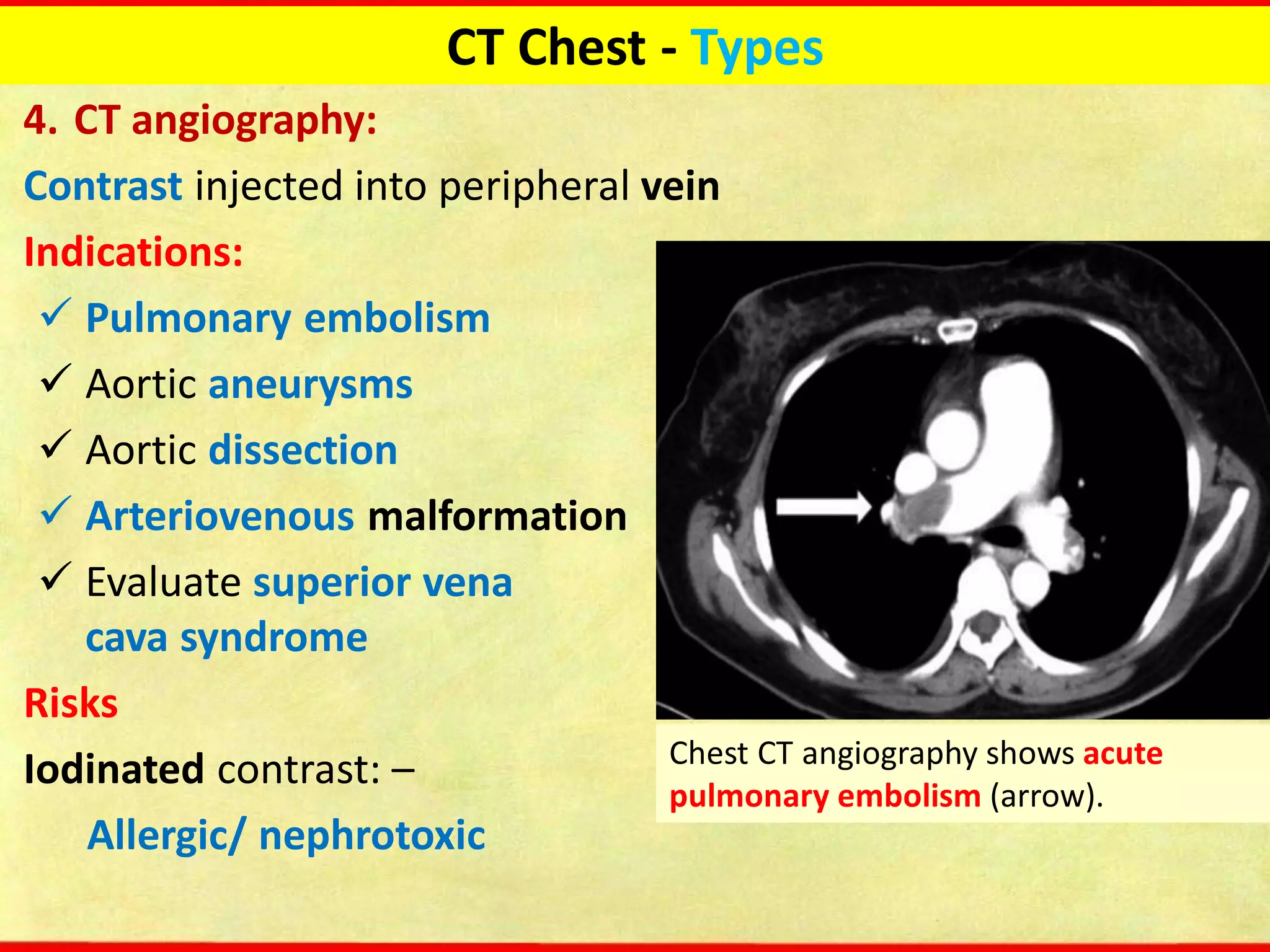 Ct chest fundamentals | PDF